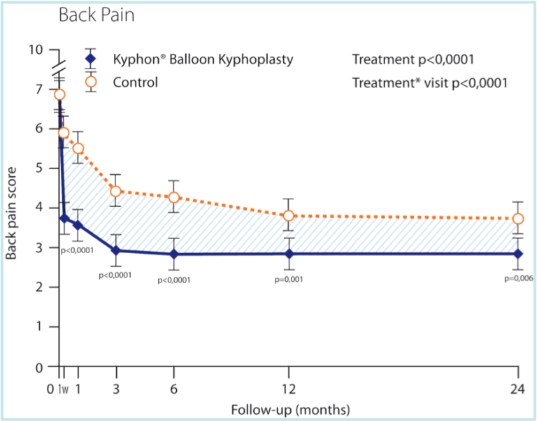 Osteoporotic Vertebral Compression Fractures Vcf The Uk Spine Centre
